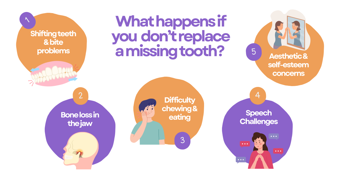 Why You Shouldn’t Ignore Missing Teeth