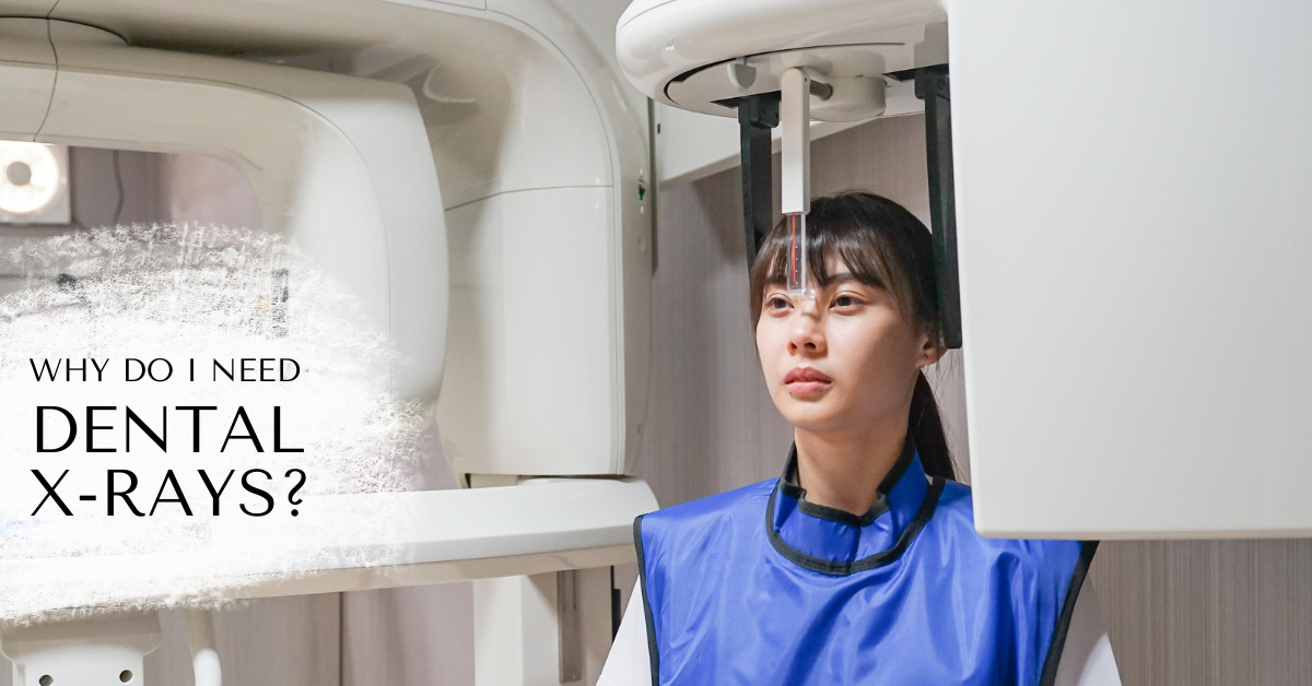 Why Do I Need Dental X-rays?