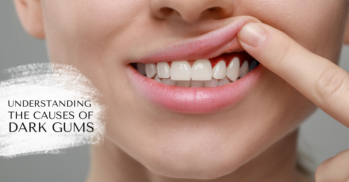 了解牙龈变黑的原因